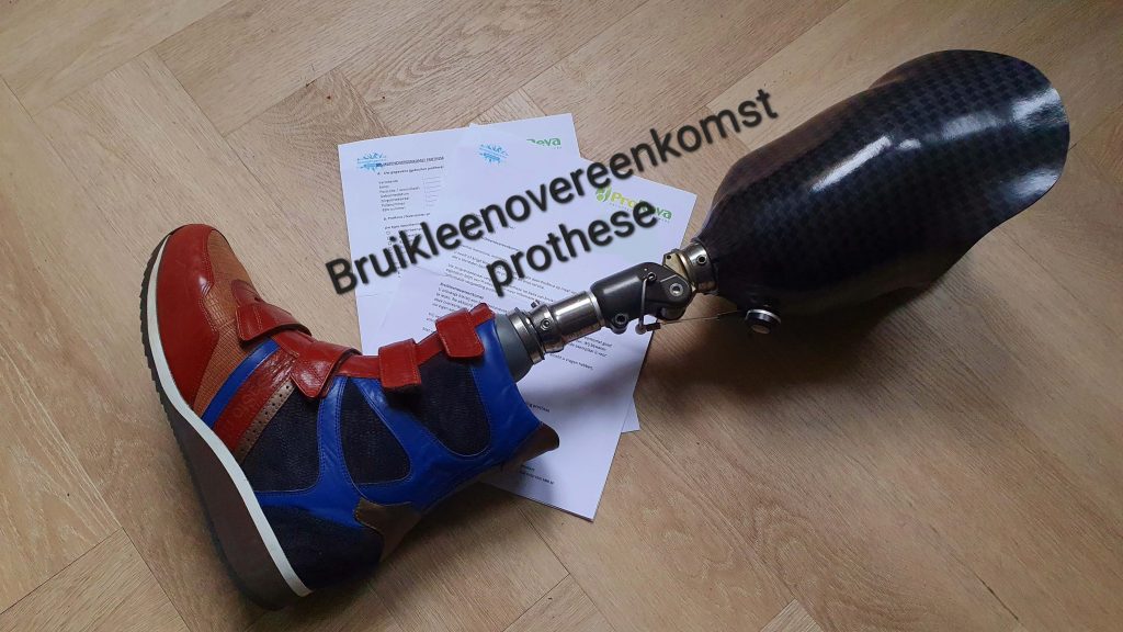 Mijn prothese is niet mijn eigendom na amputatie voor het echie - RaGaSto